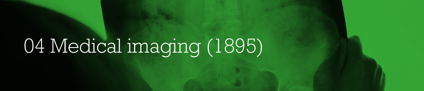 The top 10 medical advances in history | Proclinical Blogs